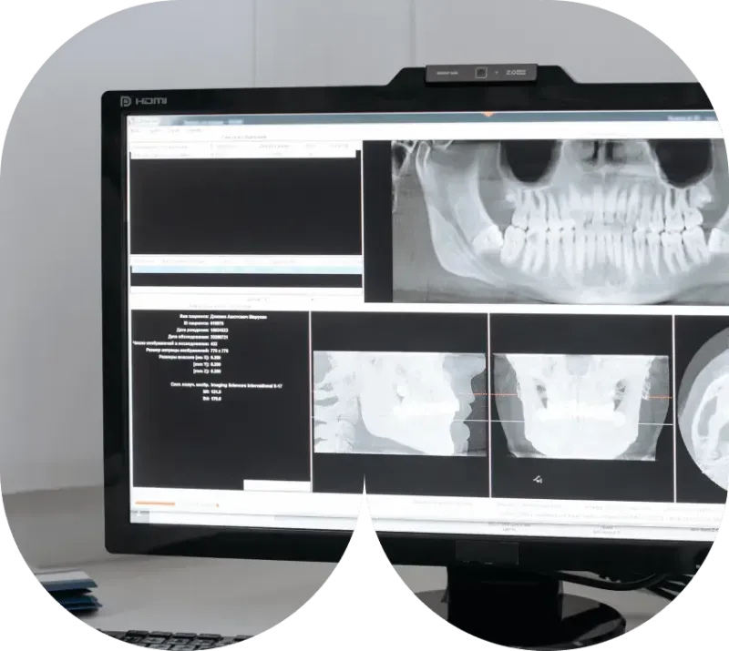 Dentist Potts Point Sydney, Dentistry at the Cross